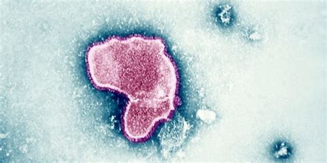 La Fda Aprueba La Primera Vacuna Para El Virus Respiratorio Sincital En
