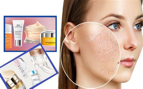 Top Dry Skin Ke Liye Best Moisturizer