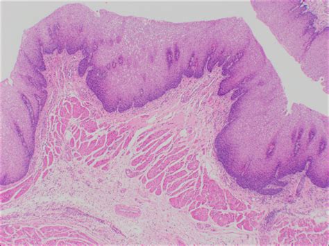 Esophagus Histology