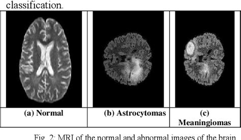 figure 2 from automatic tumor classification of brain mri images using dwt features semantic