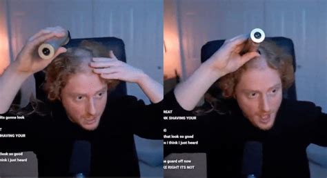 Streamer Finds Dent On His Head Made By Wearing Headphones