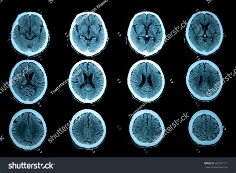 Mri Scan Image Brain Stock Photo 487297111 Shutterstock