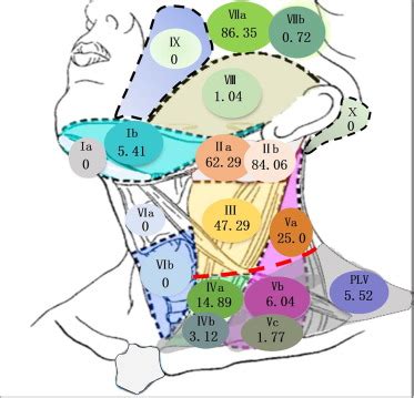 Correlation Analysis Of Neck Node Levels In 960 Cases Of Nasopharyngeal