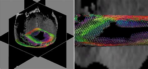 glyph based visualization of diffusion tensor shown on the background download scientific