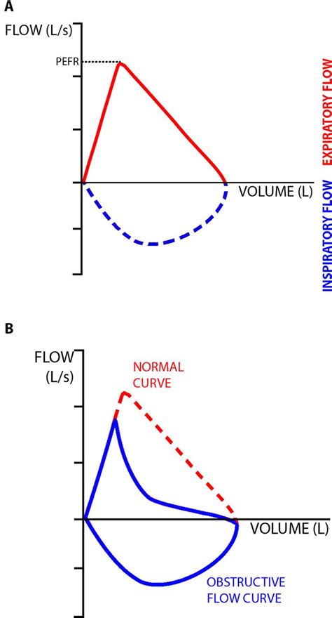 Spirometry Test Asthma
