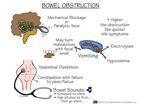 Nursing School Medical Surgical Nursing Mnemonics