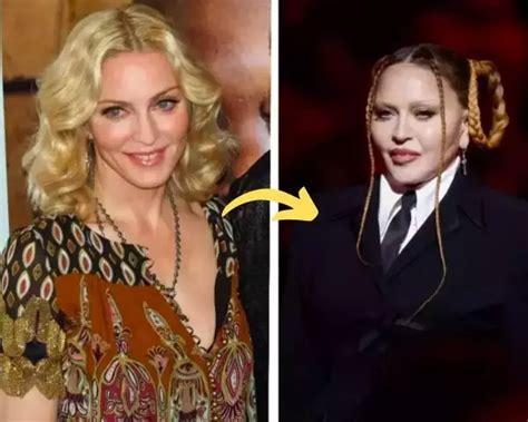 Madonna Plastic Surgery Secrets Revealed Fabbon