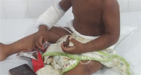 Mãe e padrasto são presos acusados de espancar criança de dois anos na