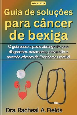 Guia De Solu Es Para C Ncer De Bexiga O Guia Passo A Passo Abrangente