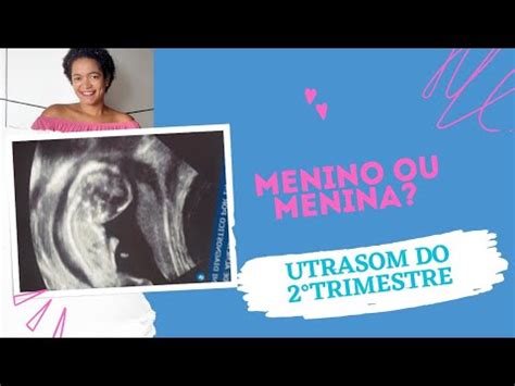Descobrindo o Sexo Do Bebê 14 semanas e 5 dias Mais Trolando Meu