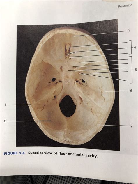 Superior View Of Floor Of Cranial Cavity Bones Diagram Quizlet