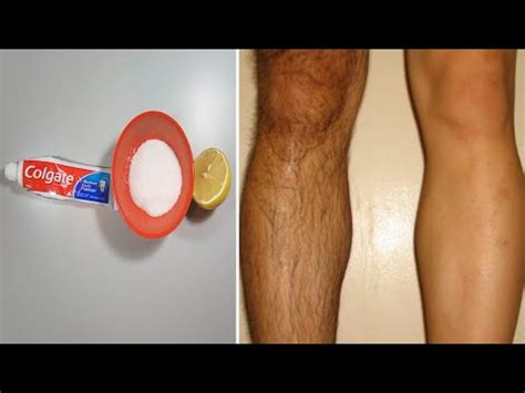 How To Remove Leg Hair Permanently YouTube