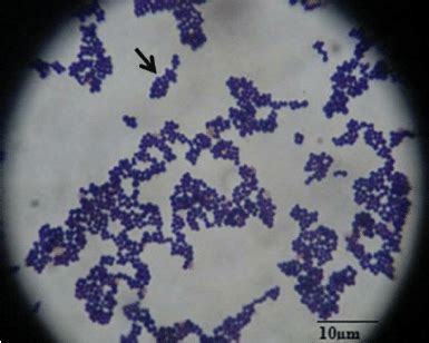 Staphylococcus Aureus Morphology Visualised Using Gram