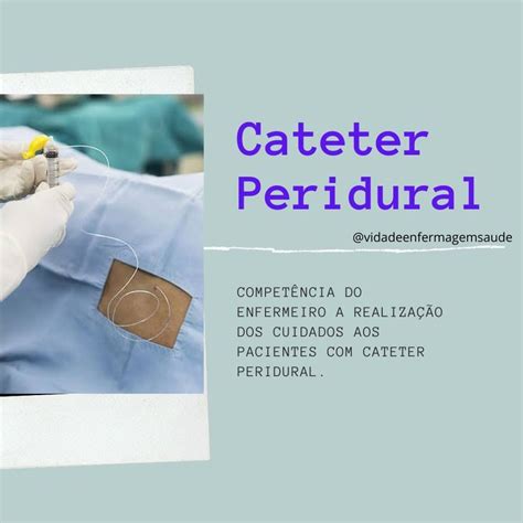 Cateter Peridural