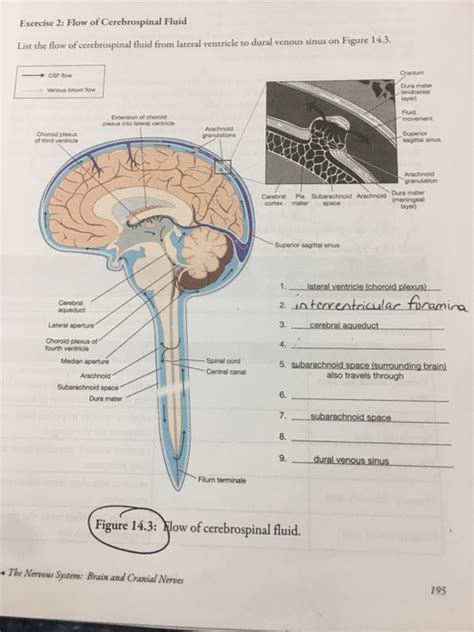 Dural Venous Sinus Anatomy Anatomy Book