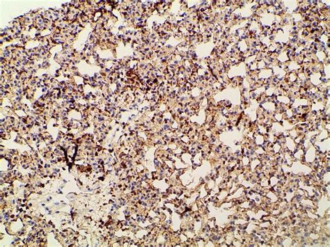Phospho PI3K p85 alpha Tyr607 Polyclonal Antibody Invitrogen 100 μL