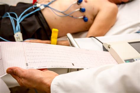 12 Lead Electrocardiogram ECG In Australia Dr Arthur Nasis