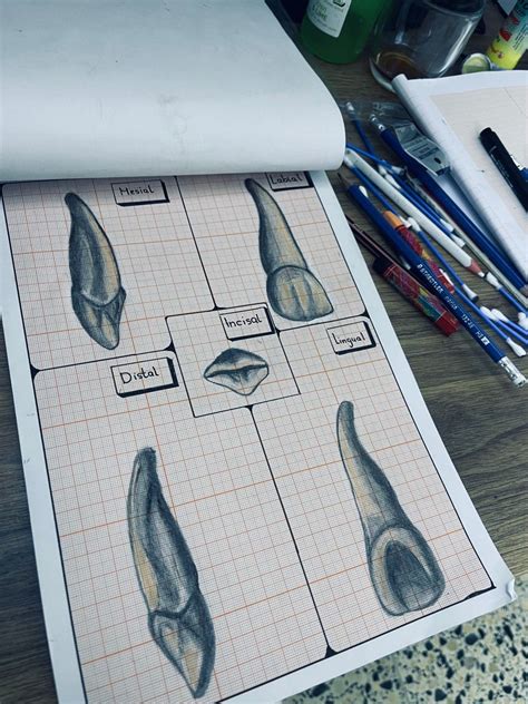Maxillary Incisors Dental Technology How To Tips Artofit