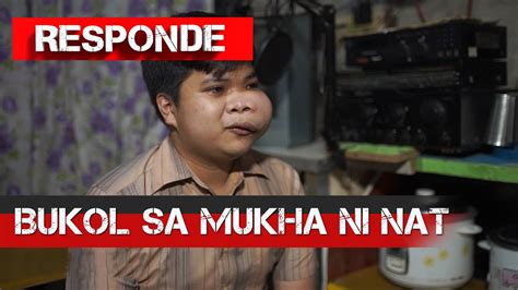 Bukol Sa Mukha Ni Nat Responde Youtube