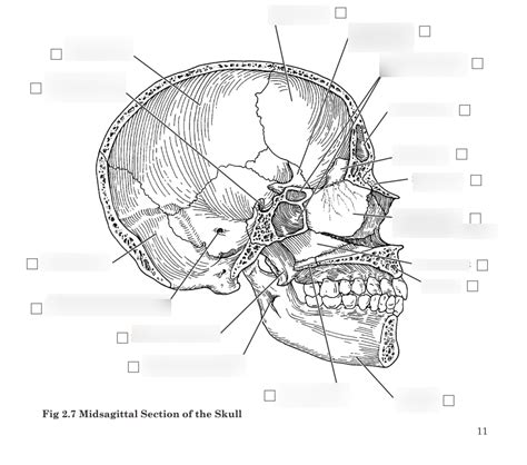Midsagittal Section Of The Skull Diagram Quizlet