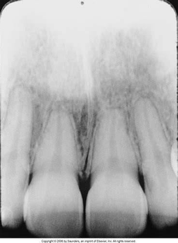 Dh Radiology Exams Flashcards Quizlet