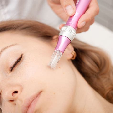 Mezoterapia mikroigłowa na twarz i okolice oczu Perfect Look Clinic