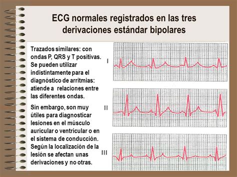 Electrocardiograma normal y cómo interpretarlo