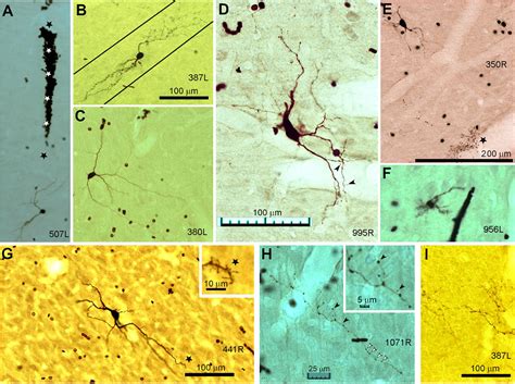 Multipolar Neuron Labeled Microscope
