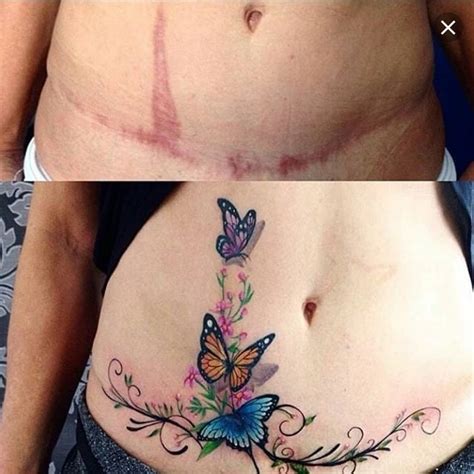50 Tatuajes Que Convirtieron A Las Cicatrices Y Marcas De Nacimiento En