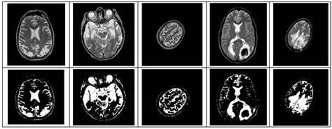 healthcare free full text cancerous and non cancerous brain mri classification method based