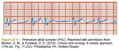 SCR 210 Chapter 22 Management Of Patients With Arrhythmias And