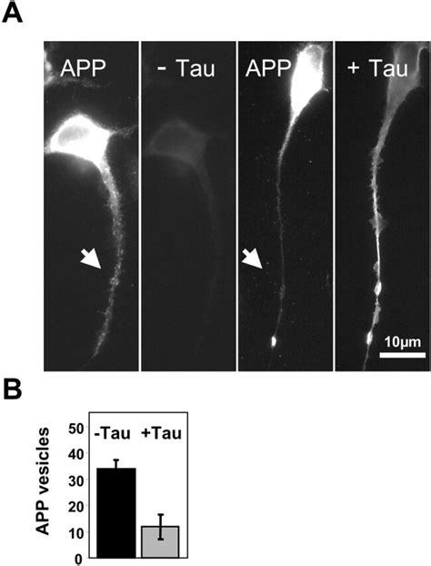 Reduction Of APP Containing Vesicles In Neurites Of N2a Cells By Tau