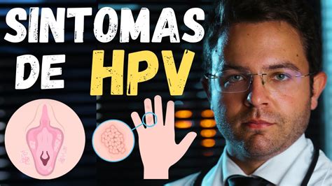 SINTOMAS DO HPV Papiloma Vírus Humano DOENÇA PERIGOSA SILENCIOSA E