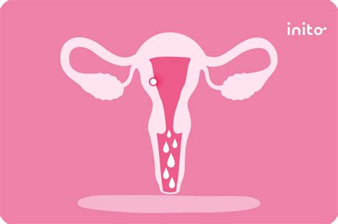 Is Heavy Implantation Bleeding Normal