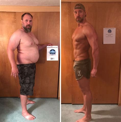 All Images Before And After Weight Loss Side View Excellent