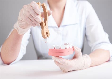 Cu Ndo Hay Que Extraer Las Muelas Del Juicio Cl Nica Dental Dr