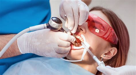 Corona Dental De Porcelana Tipos Ventajas E Inconvenientes Estudi