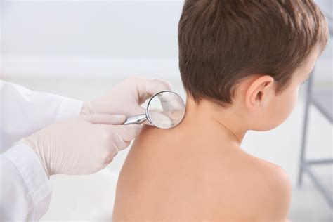 Molluscum Contagiosum Symptoms Causes And Treatments Activebeat