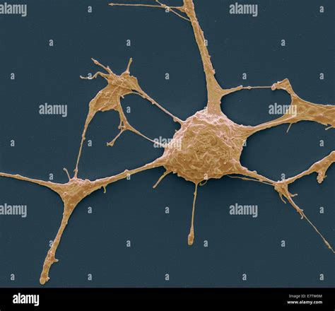 Neurone Scanning Electron Micrograph Sem Of A Pc Neurone In Stock