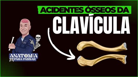 O Que Sao Acidentes Osseos REVOEDUCA