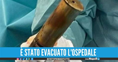 Proiettile da 20 cm nell ano non riesce più ad estrarlo corsa in ospedale