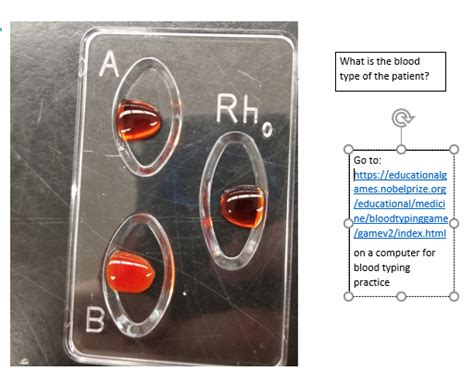 Blood Typing Diagram Quizlet