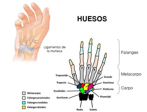 Esguince de Muñeca Síntomas Causas y Tratamiento Farmalastic