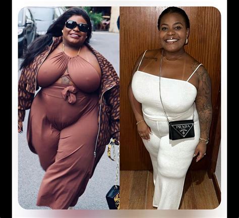 Foto Antes E Depois De Jojo Todynho Funkeira Passou Por Cirurgia