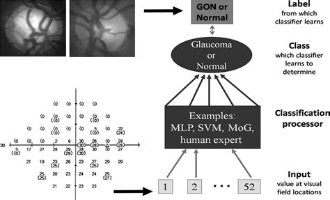 machine learning classifiers in glaucoma optometry and vision science
