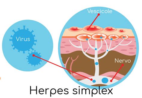 Herpes Genitale Sintomi E Cura In Uomini E Donne Valori Normali