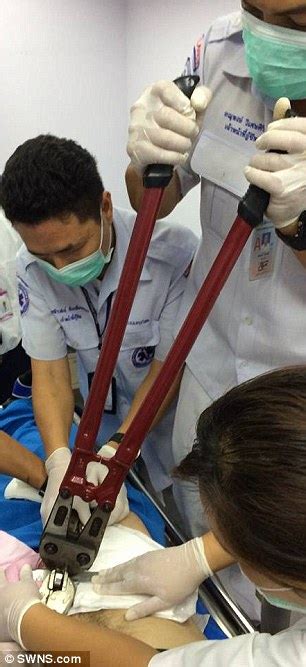 Thai Man Has A Sex Ring Removed With BOLTCUTTERS After It Became Stuck