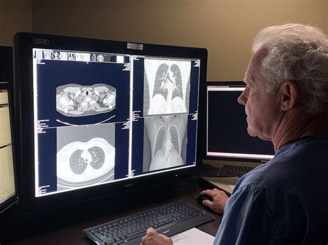 Lung Cancer Screening CT Naperville Radiologists