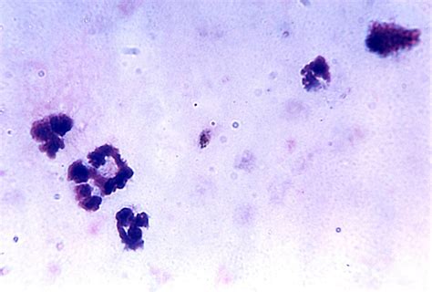 Free Picture Blood Smear Photomicrograph Plasmodium Falciparum
