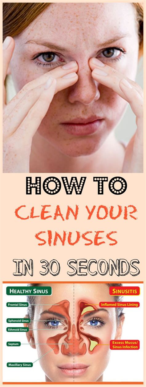 HOW TO CLEAN YOUR SINUSES IN 30 SECONDS Sinusitis Chest Congestion